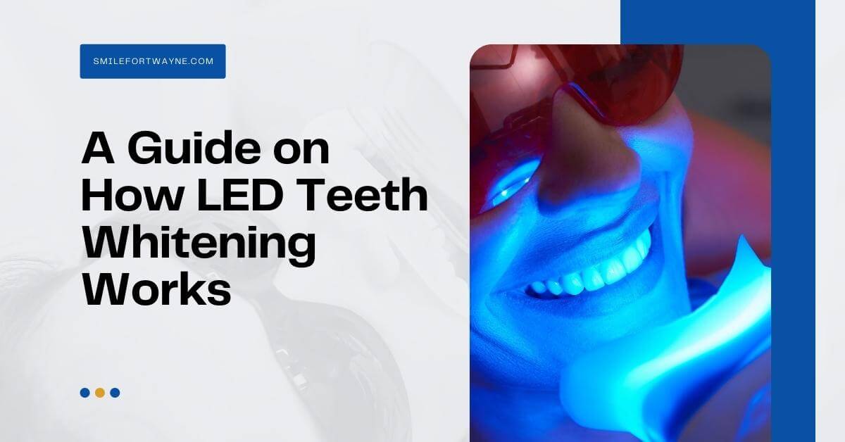 A Guide on How LED Teeth Whitening Works - Family Dentistry ...