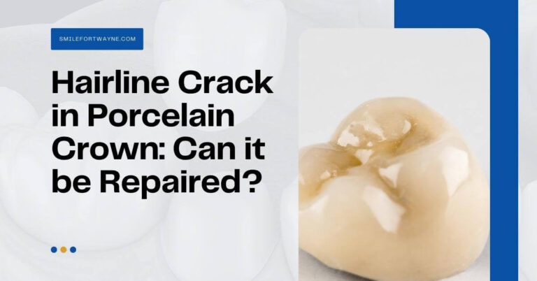 Hairline Crack in Porcelain Crown: Can it be Repaired? - Family ...